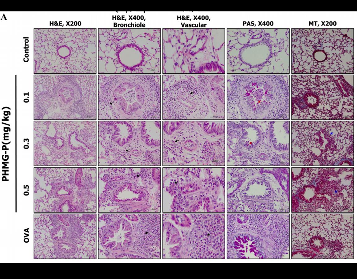 가습기 살균제 성분, 유사 천식 유발 확인