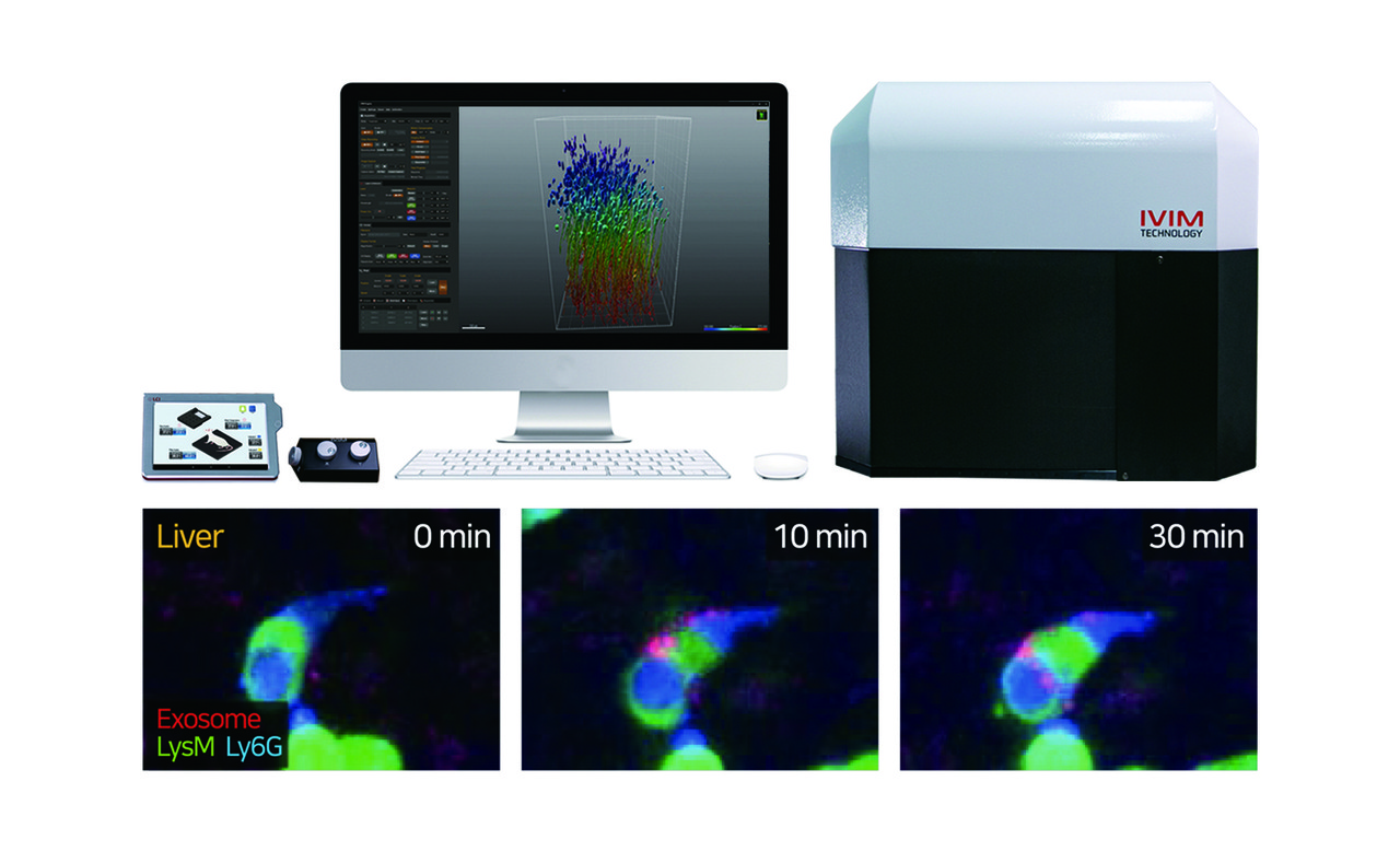 Advancing into the Global Market with Biomicroscopy, Joining the League ...