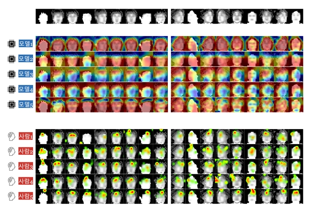사람 눈처럼 인식, AI 활용 인공시각 장치 개발